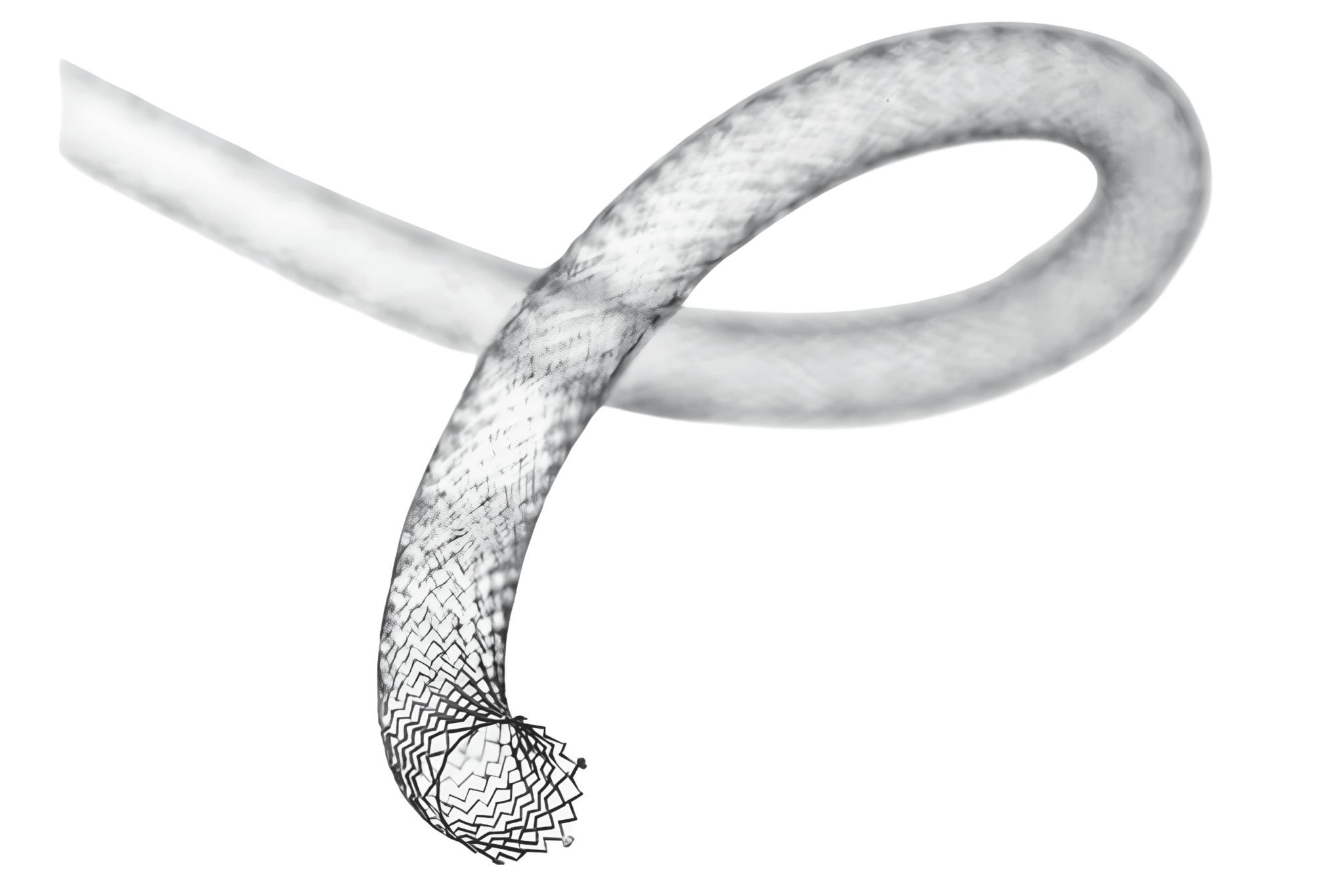 Lifestent – stent vascular – Wave Medical