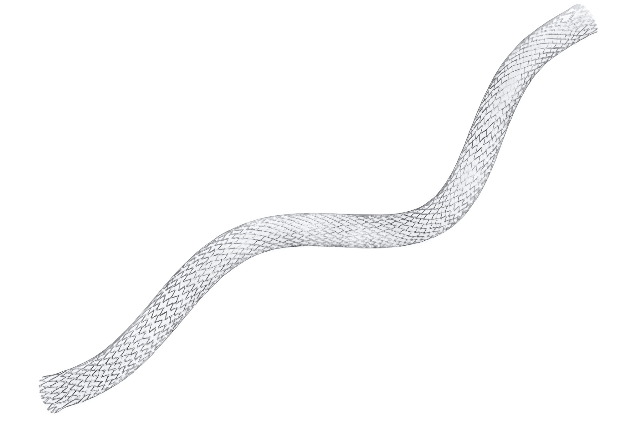 Lifestent Vascular Stent – Wave Medical